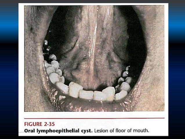 Lab 6 developmental cyst | PPT