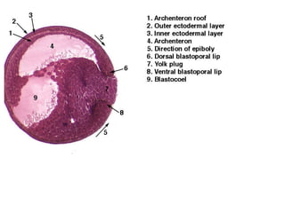 Gastrula Slide