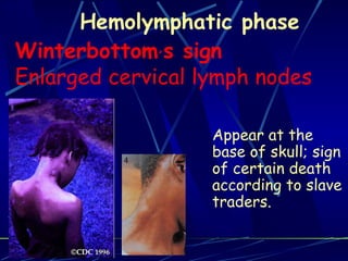 Lab 7 trypanosomiasis | PPT