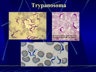 Trypanosoma Microscope Slide