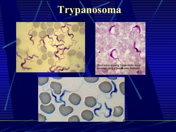Lab 7 trypanosomiasis