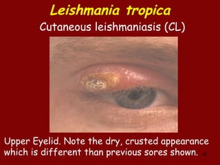 Lab 8 leishmaniasis | PPT