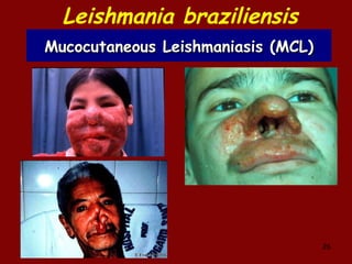 Lab 8 leishmaniasis | PPT