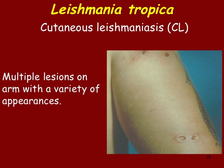 Lab 8 leishmaniasis