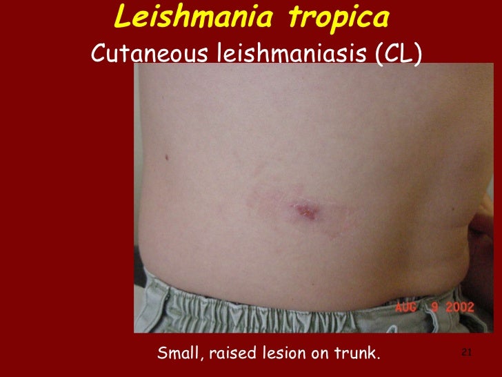 Lab 8 leishmaniasis