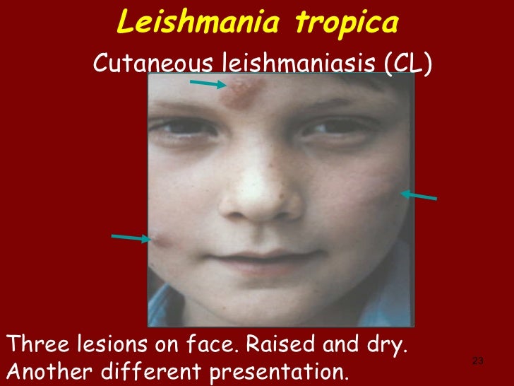 Lab 8 leishmaniasis