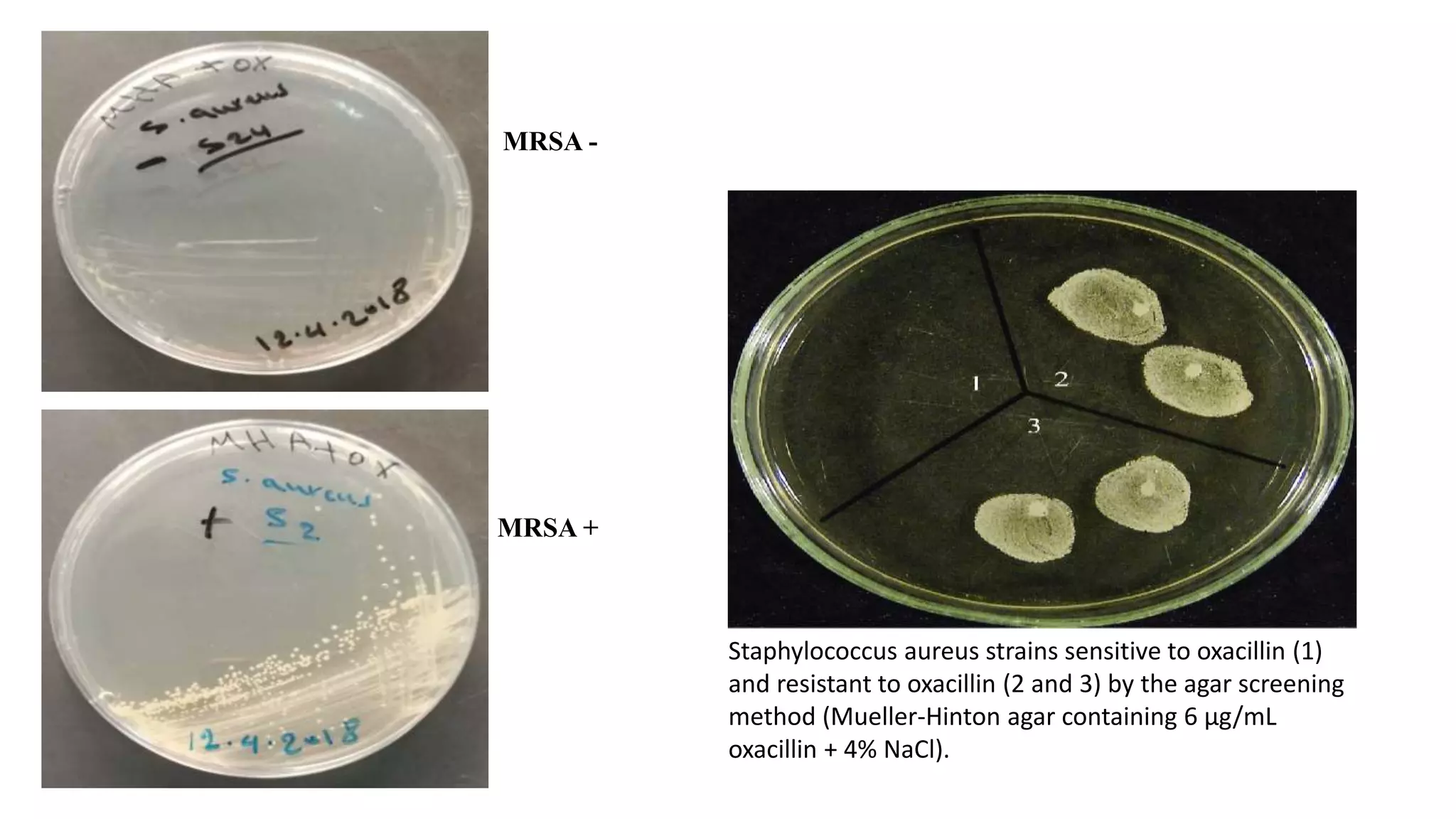 MRSA Detection | PPTX