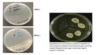 MRSA Detection | PPTX