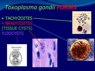 Toxoplasma Gondii Tachyzoites