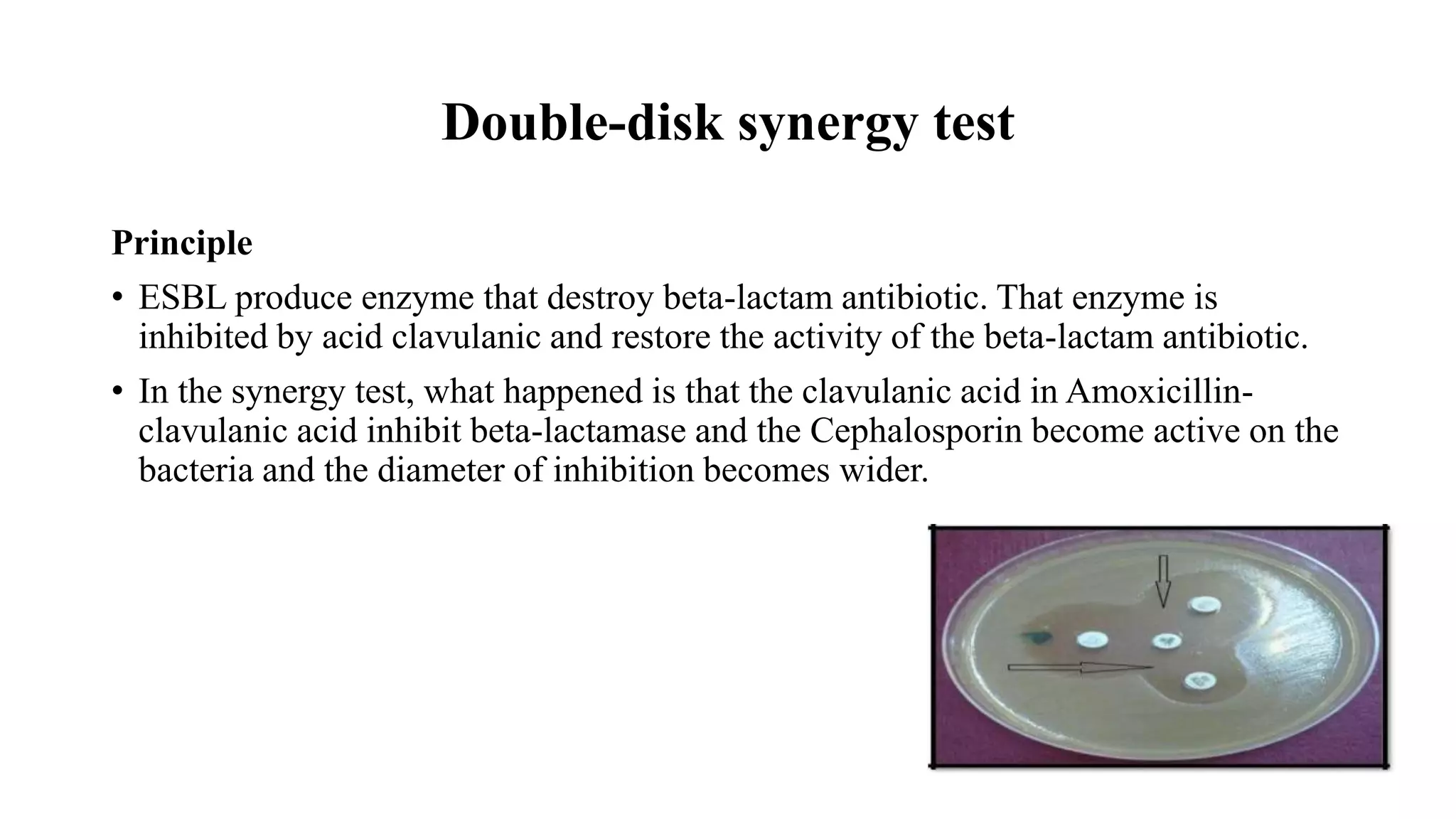 ESBL Detection | PPTX