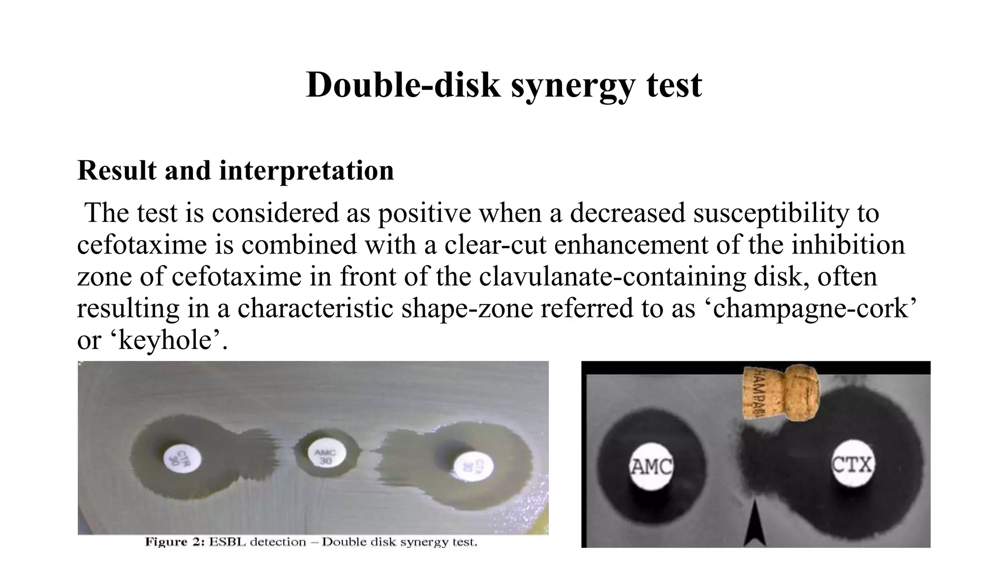 ESBL Detection | PPTX