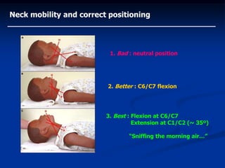 Airway management in the Emergency Department for Trainees | PPT