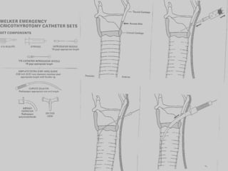 Airway management in the Emergency Department for Trainees | PPTX