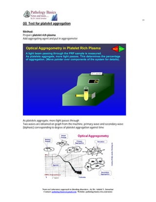 Laboratory approach to bleeding disorders | PDF