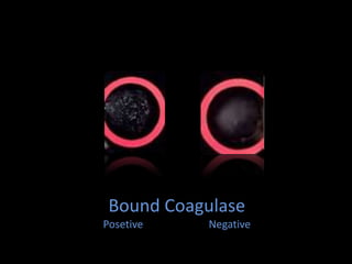 Lab biochem. id and ast | PPT