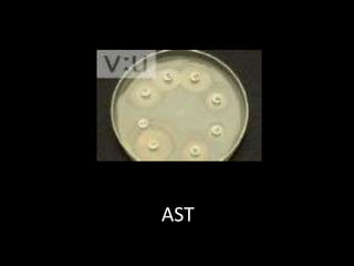 Lab biochem. id and ast | PPT
