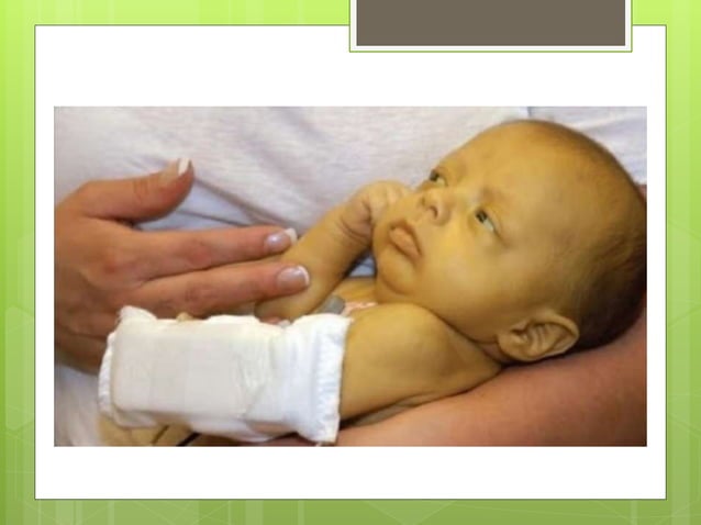 Lab data interpretation in pediatrics | PPTX