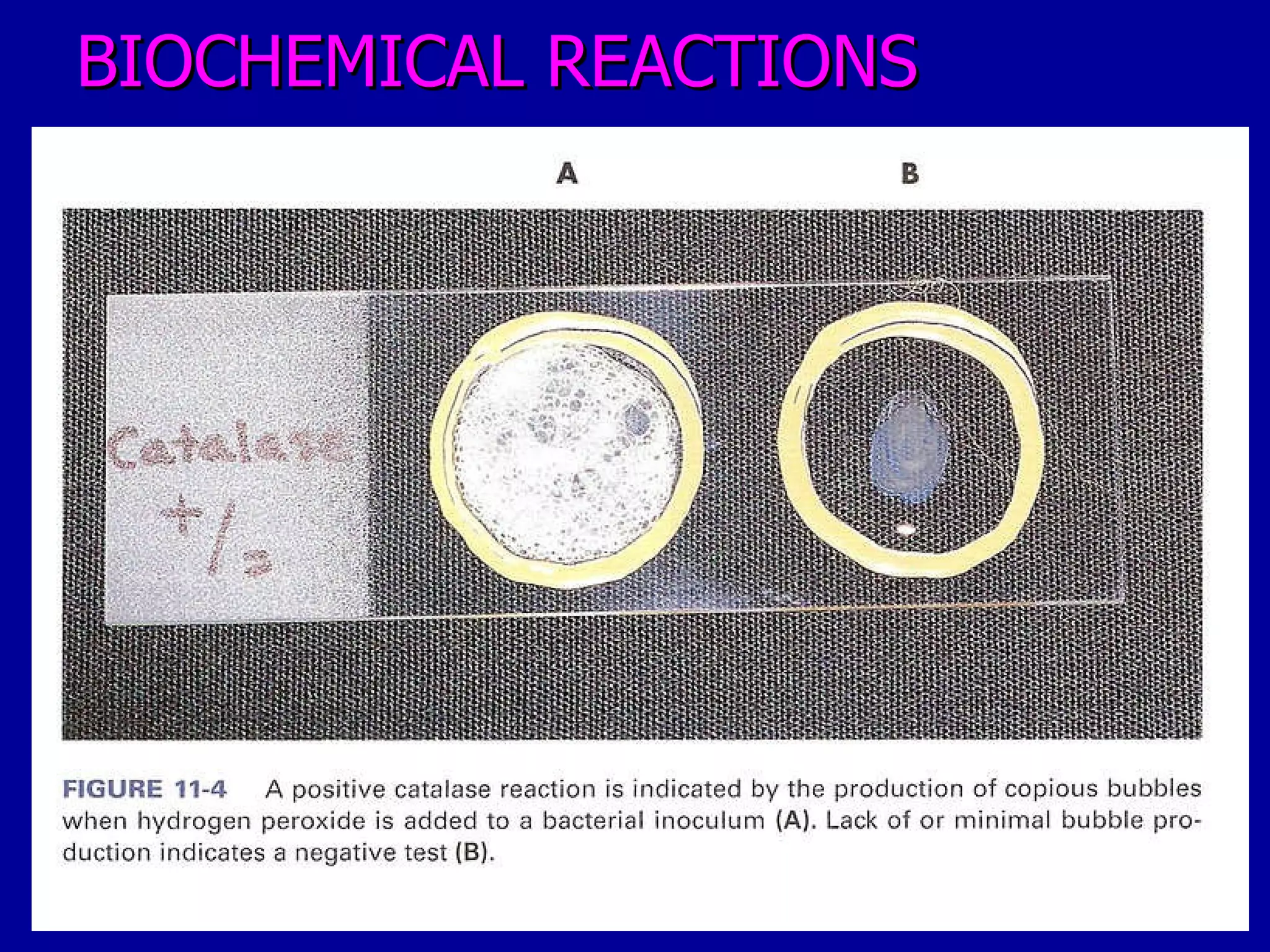 Lab Diag Tb Ppt