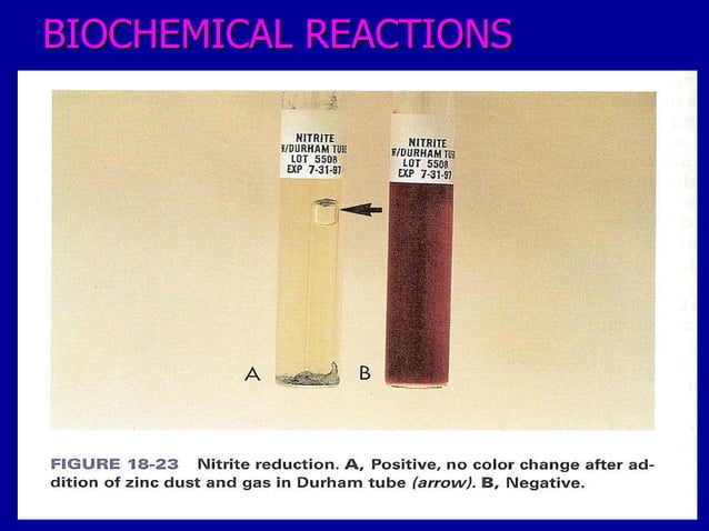 Lab diag. tb | PPT