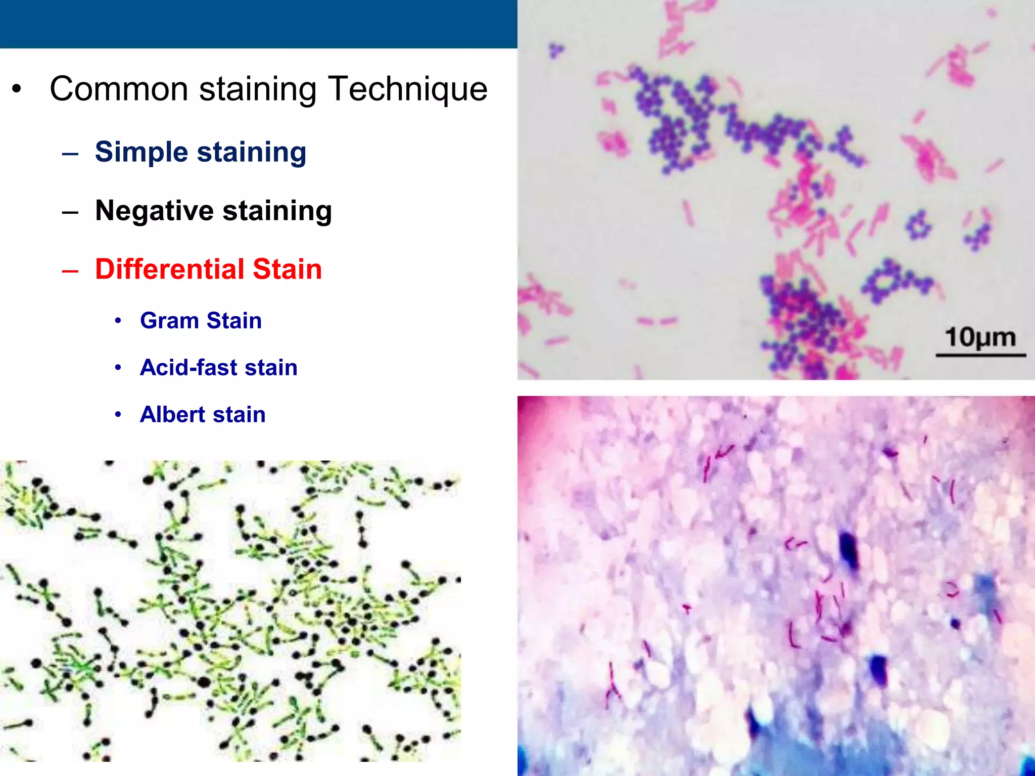 Lab Diagnosis of Bacterial infections | PPT