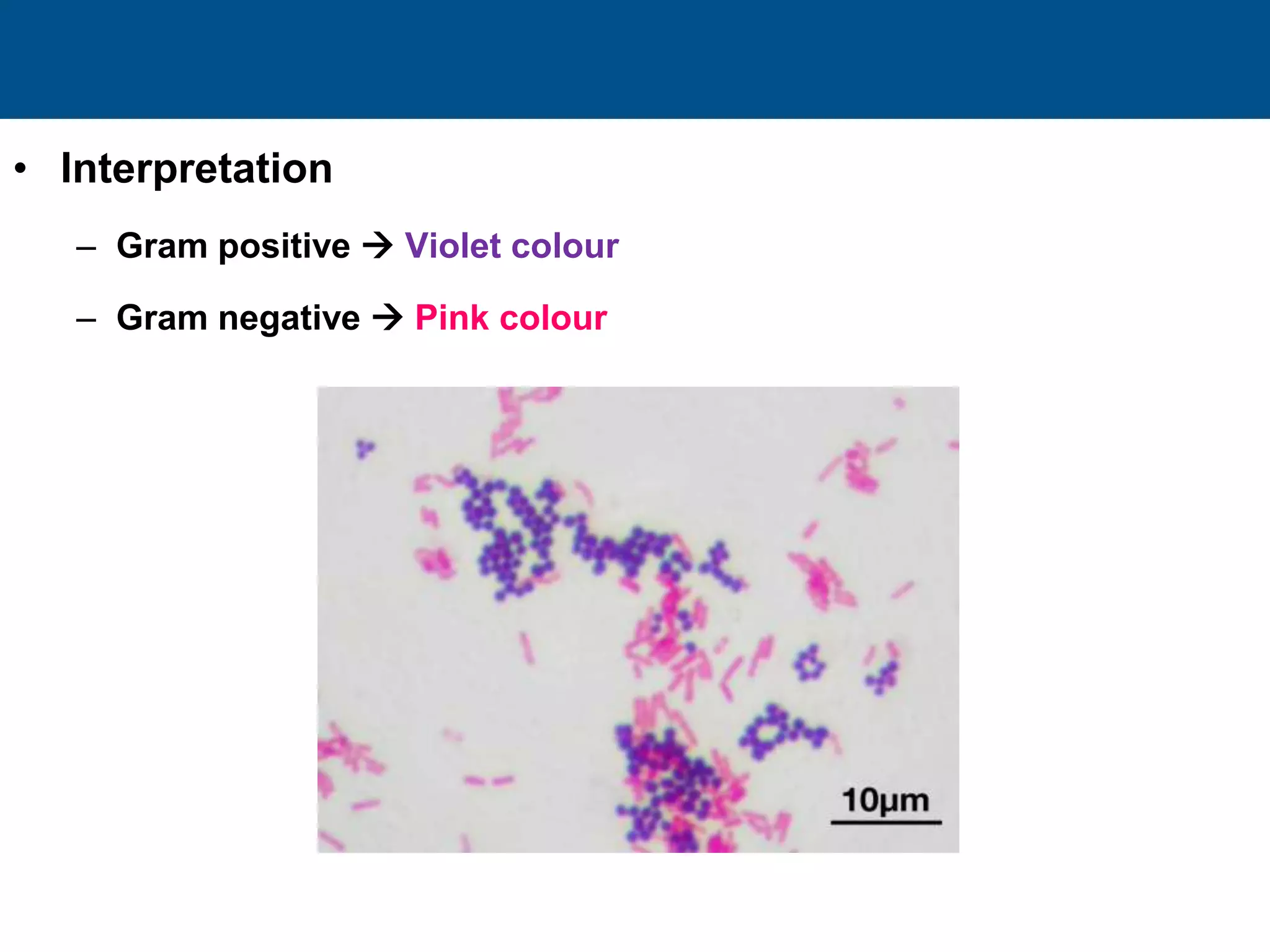 Lab Diagnosis of Bacterial infections | PPT