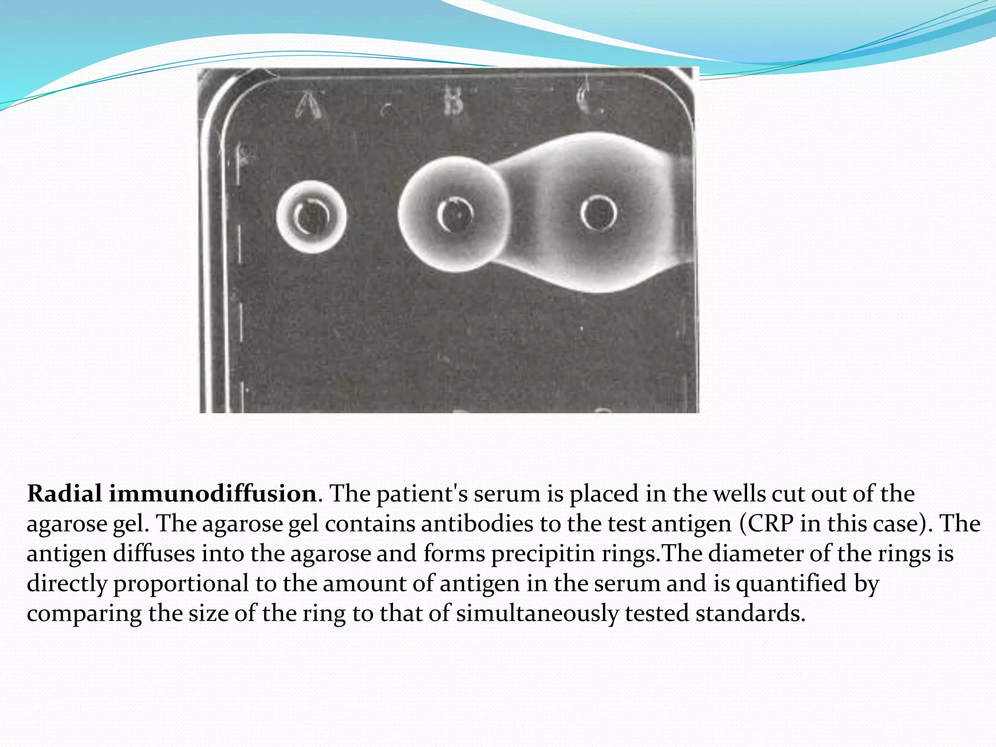 Lab diagnosis autoimmune disease | PPTX