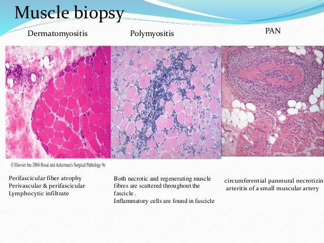 Lab diagnosis autoimmune disease