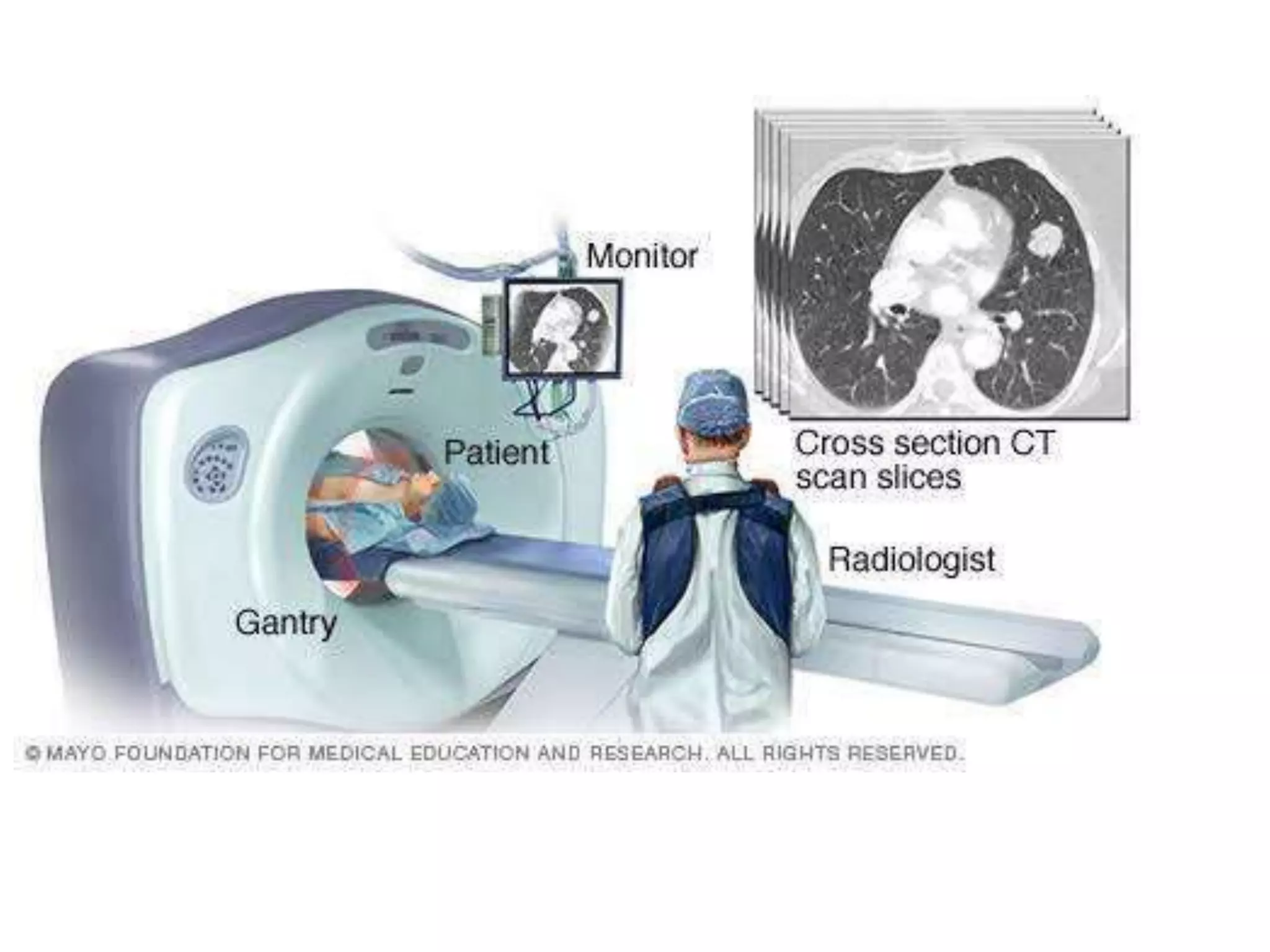 Lab diagnosis cancer | PPTX