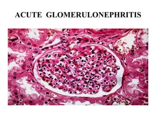 Lab diagnosis in renal diseases | PPTX