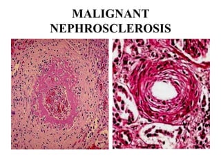 Lab diagnosis in renal diseases | PPTX