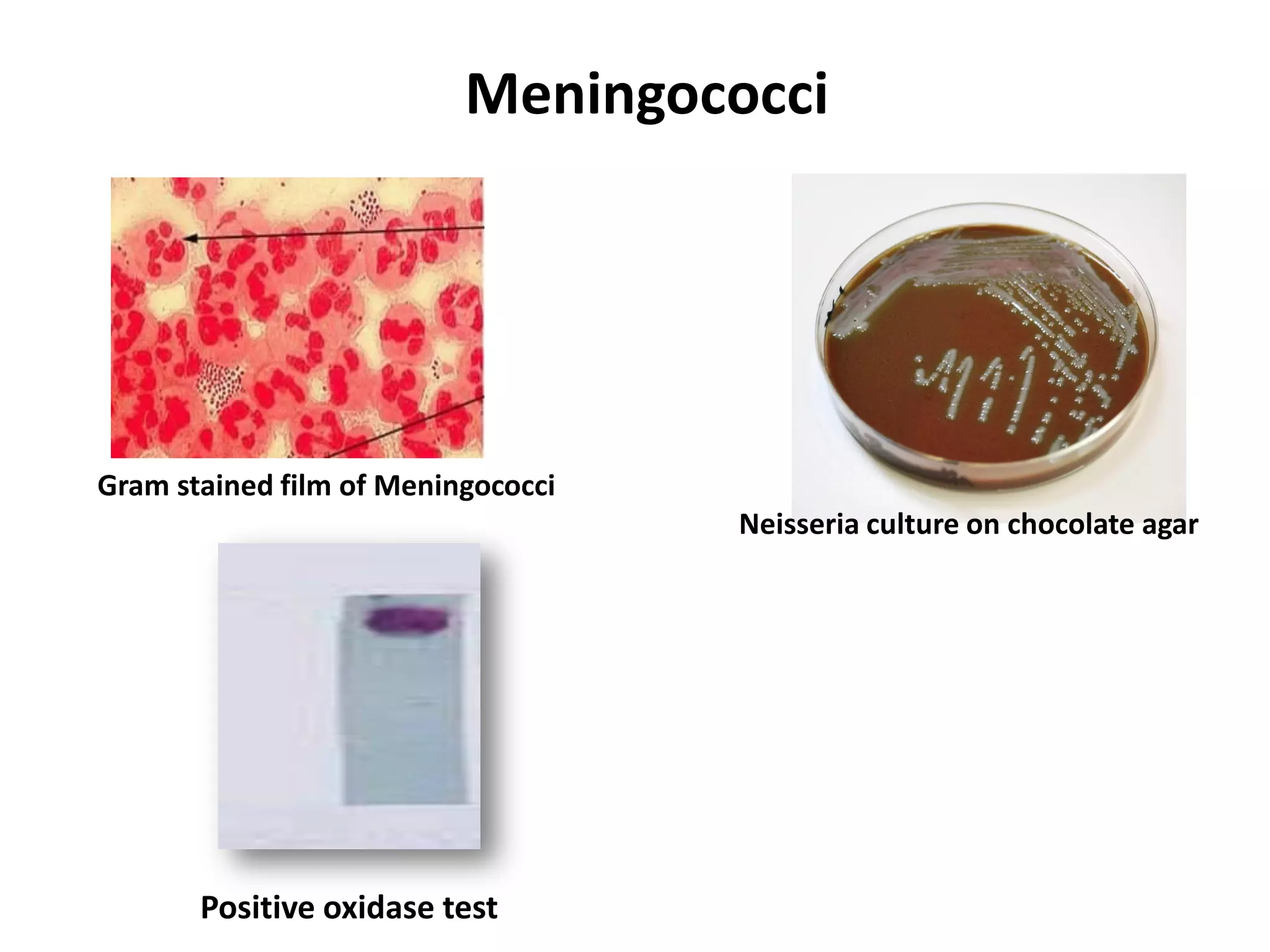 lab diagnosis od meningitis.pdf