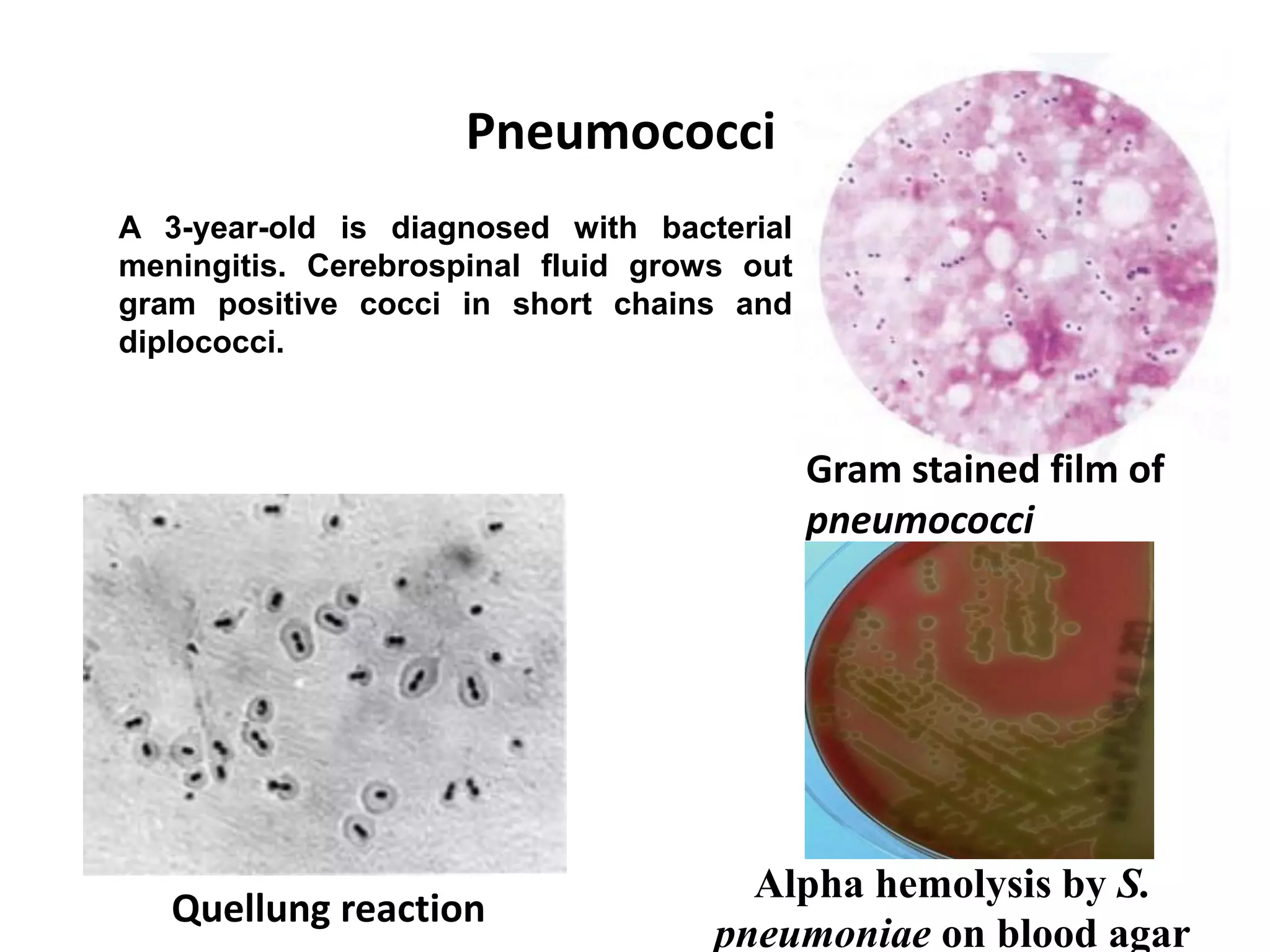 lab diagnosis od meningitis.pdf