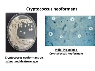 lab diagnosis od meningitis.pdf