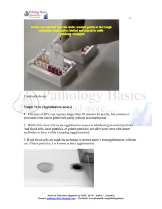 LABORATORY DIAGNOSIS OF HIV - AIDS | PDF