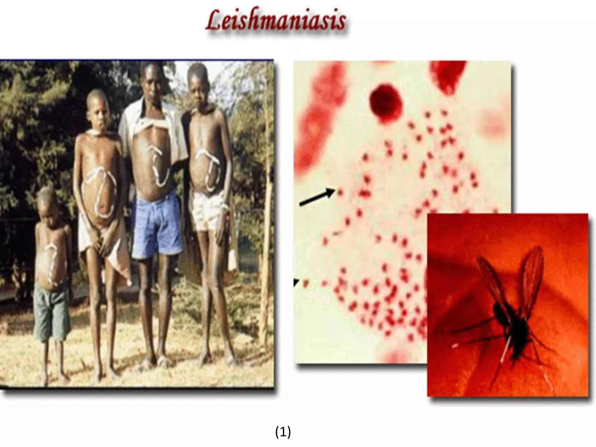 LAB DIAGNOSIS OF LEISHMANIASIS.pptx