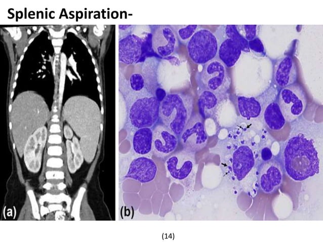 LAB DIAGNOSIS OF LEISHMANIASIS.pptx