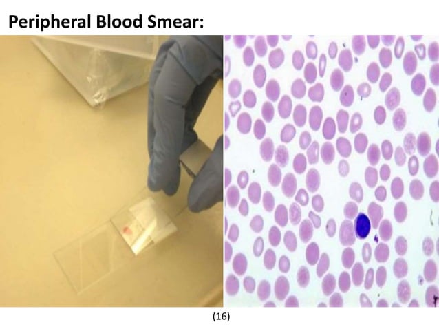 LAB DIAGNOSIS OF LEISHMANIASIS.pptx