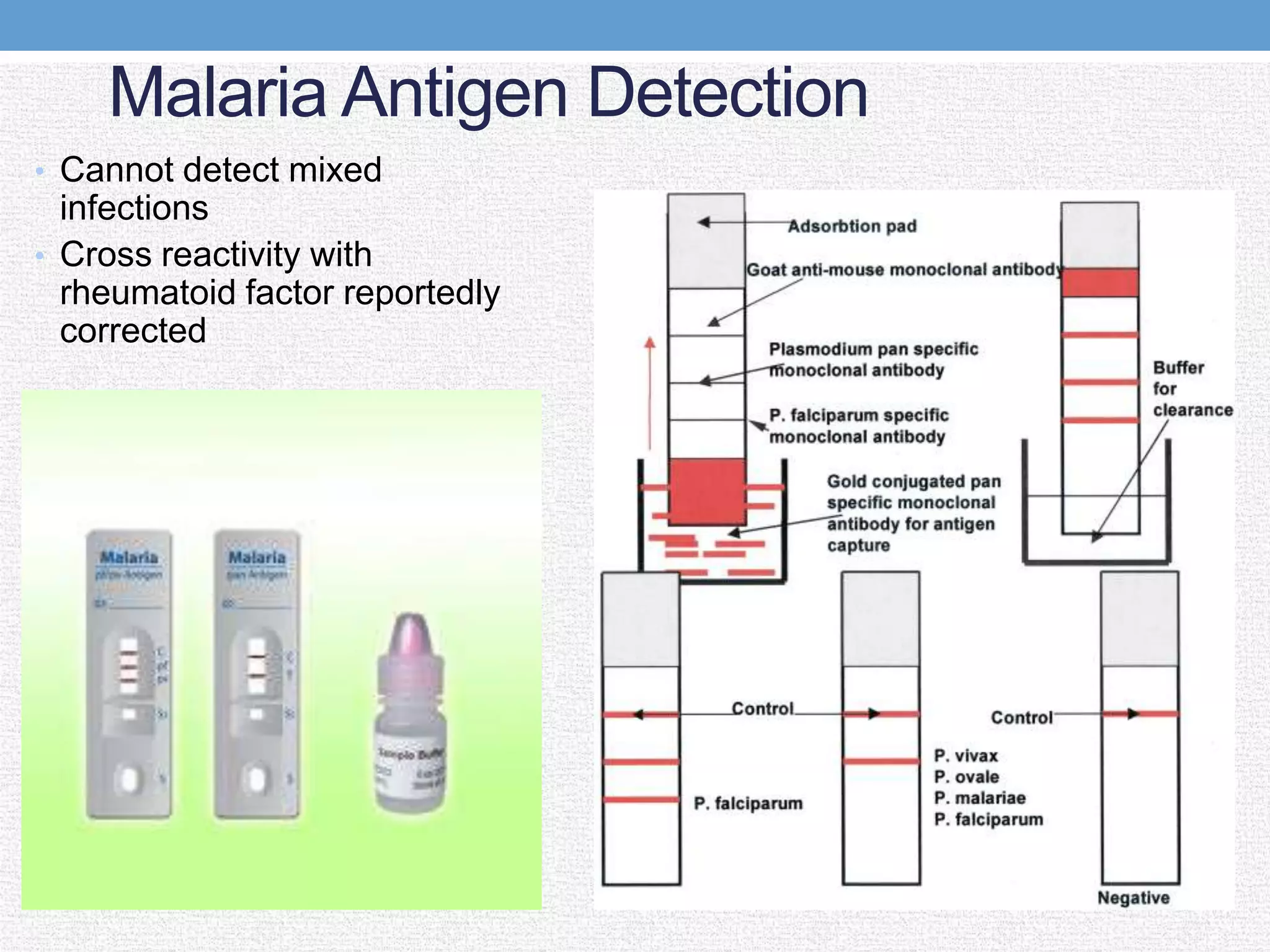 Lab diagnosis of malaria | PPSX