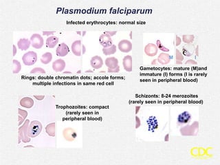 Lab diagnosis of malaria | PPSX
