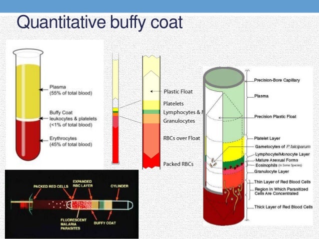 Quantitative Buffy Coat Qbc Test Principle Method And
