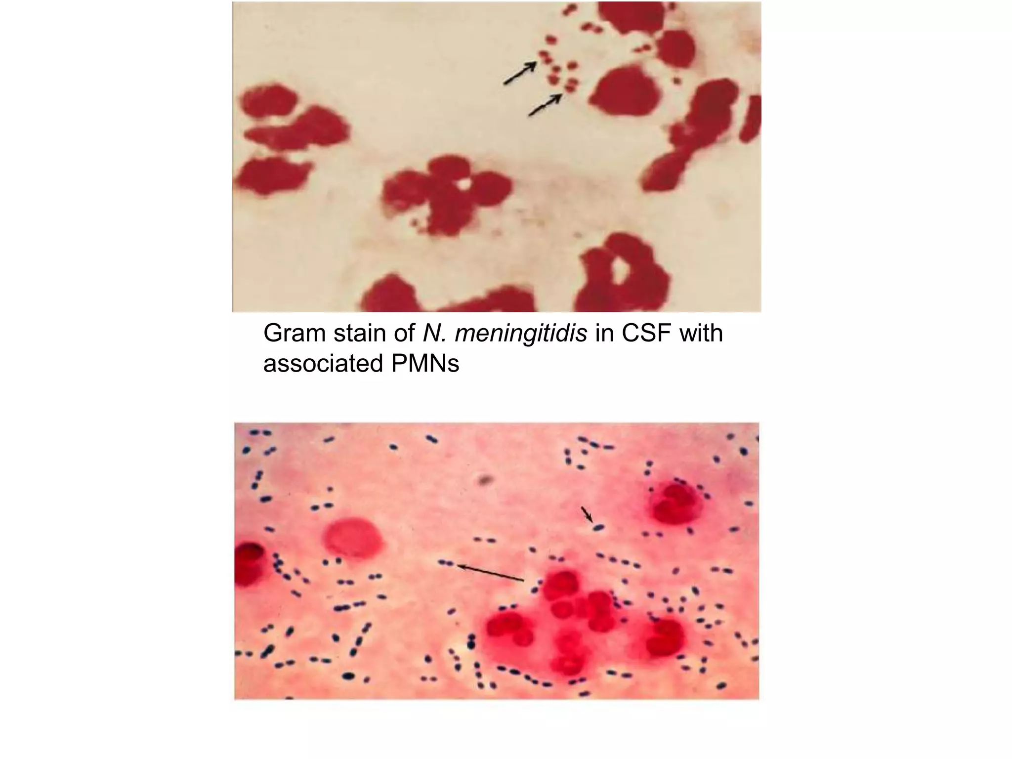 lab diagnosis of meningitis.pptx