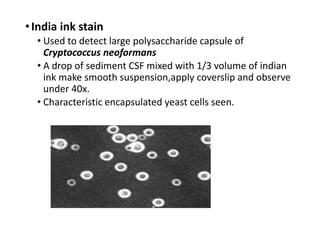 lab diagnosis of meningitis.pptx