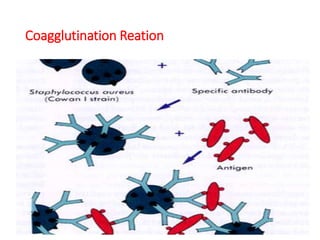 lab diagnosis of meningitis.pptx