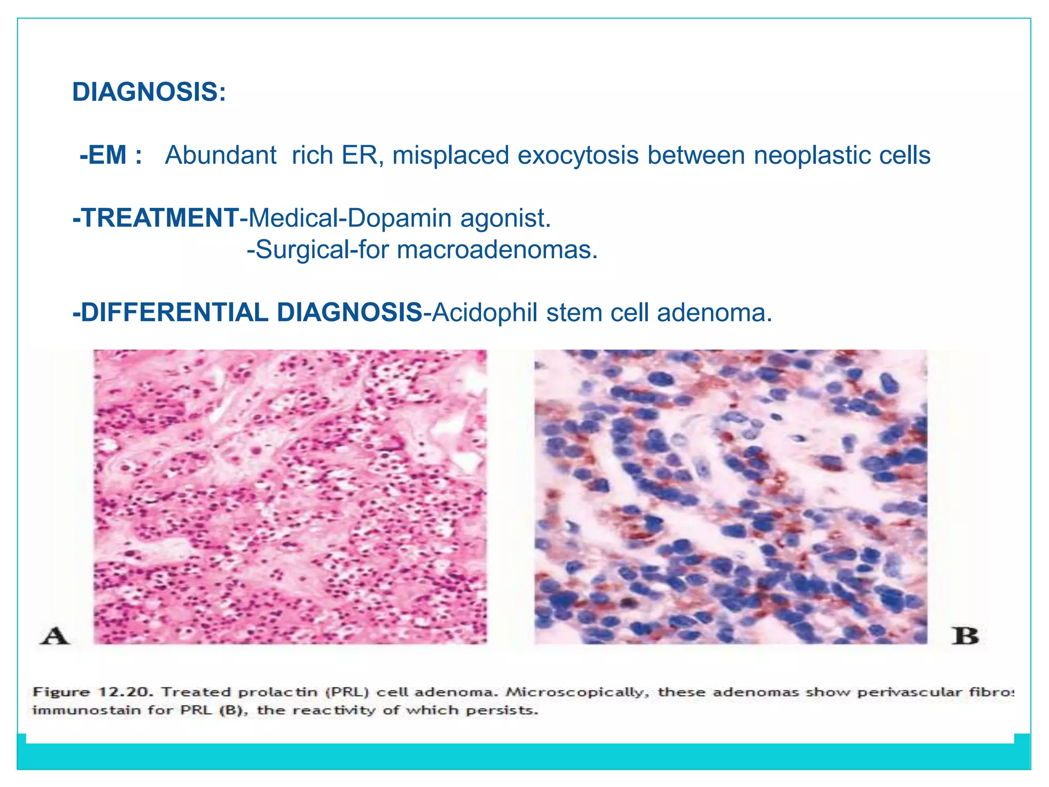 Lab diagnosis of pituitary tumors | PPTX