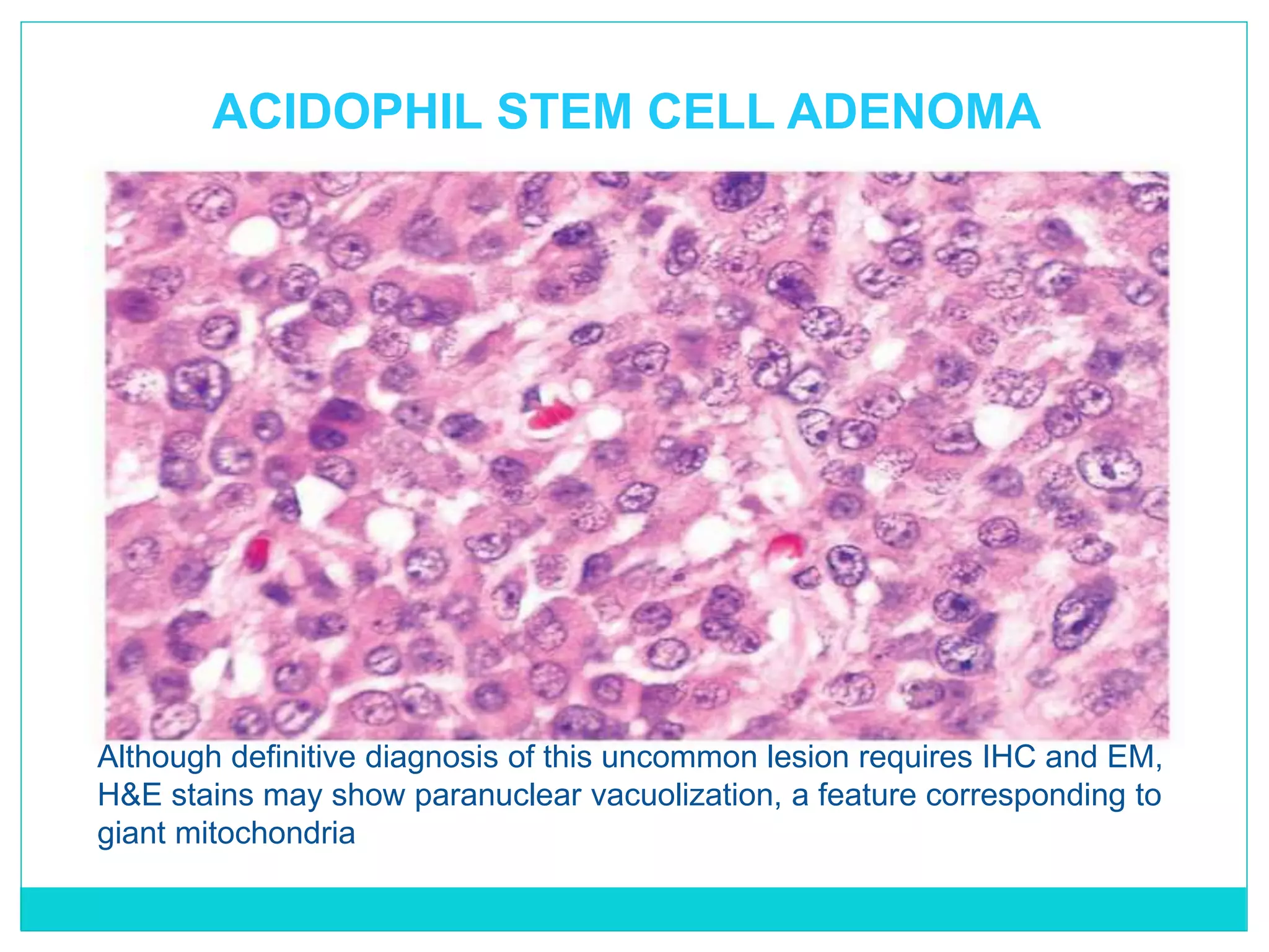 Lab diagnosis of pituitary tumors | PPTX