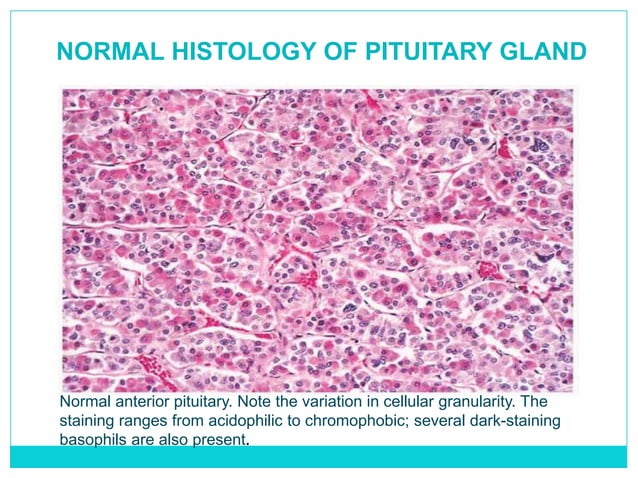 Lab diagnosis of pituitary tumors | PPTX
