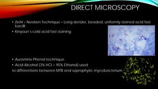 Lab diagnosis,investigations of pulmonary tuberculosis | PDF