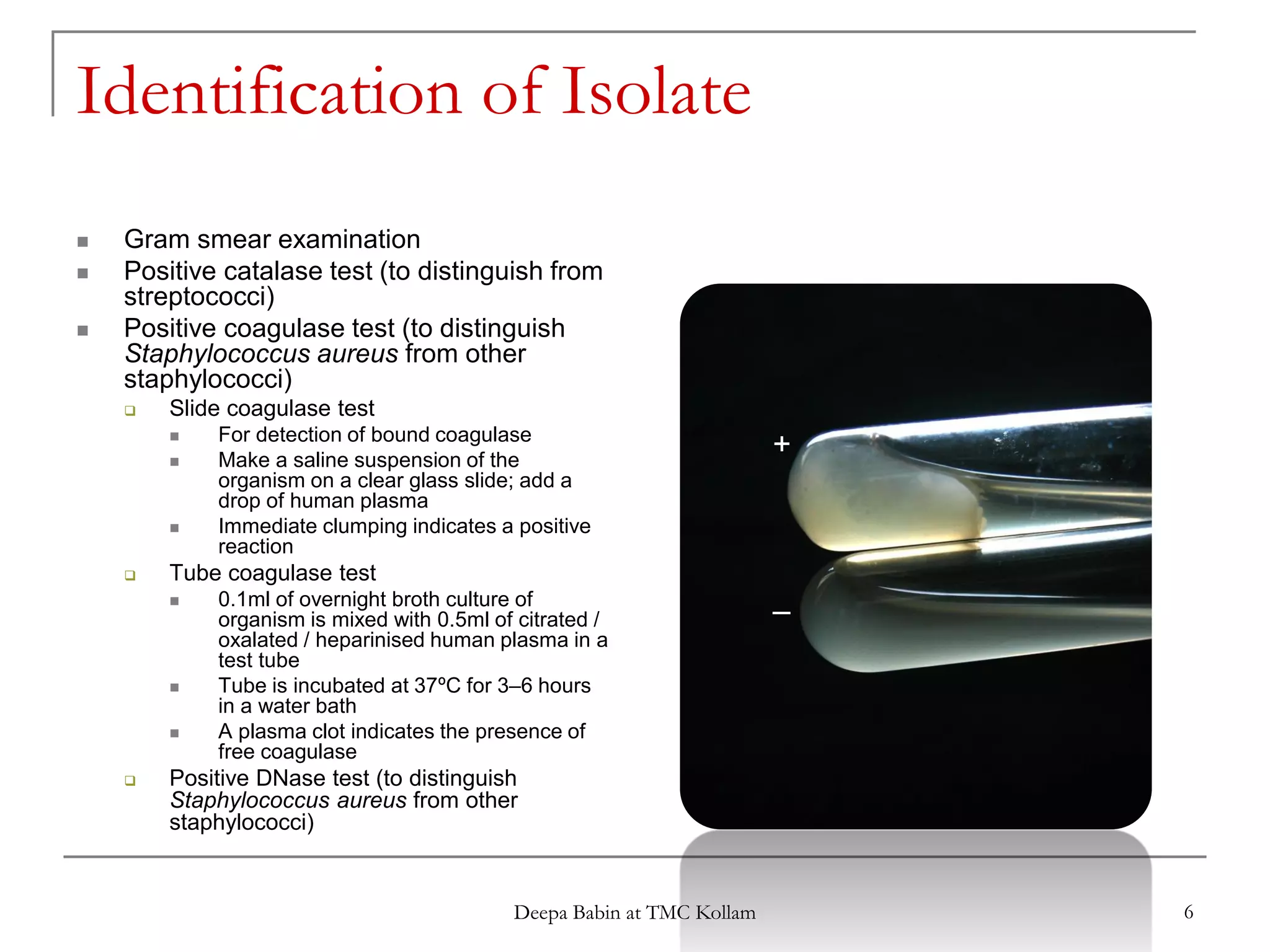 Lab diagnosis of staphylococcal infections deepa babin | PDF