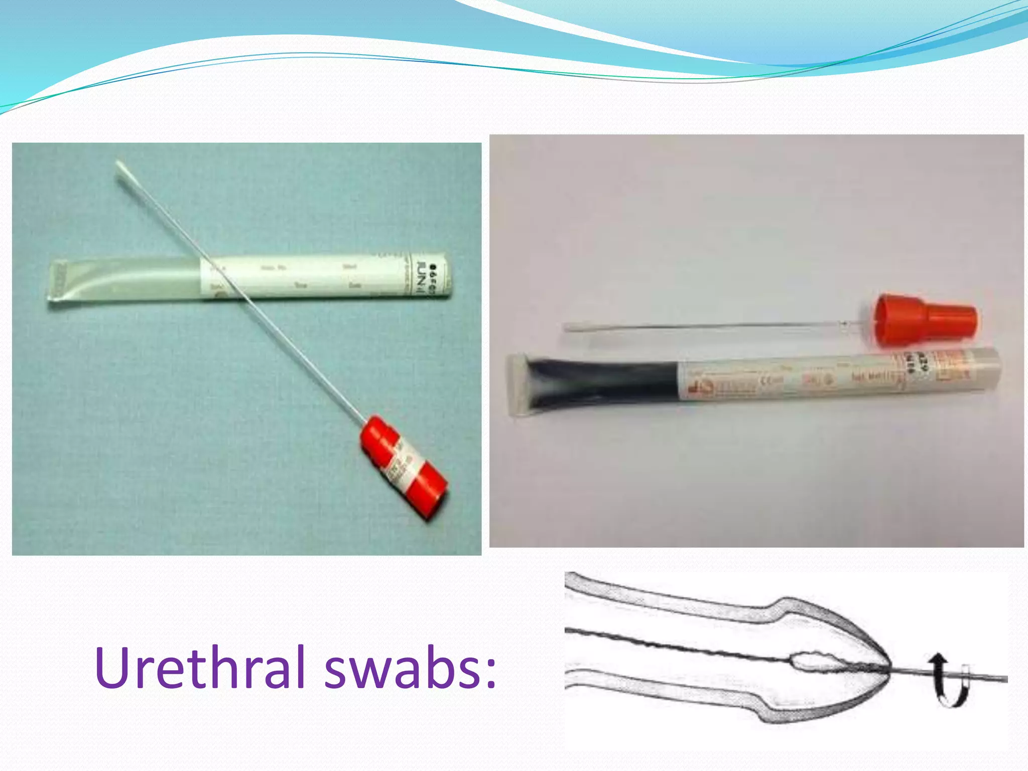 Lab diagnosis of Sexually transmitted Infections (STIs) | PPTX