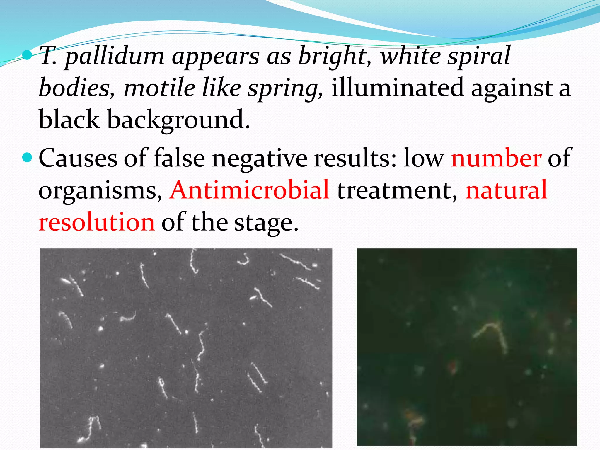 Lab diagnosis of Sexually transmitted Infections (STIs) | PPTX